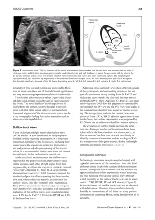 ISUOG Practice Guidelines (updated): sonographic screening examination ...