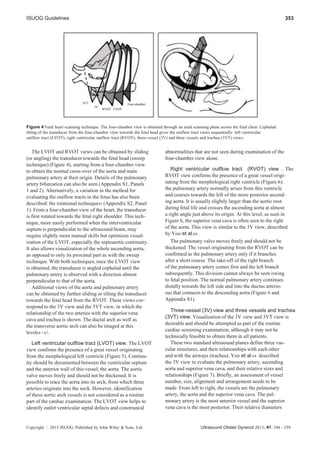 ISUOG Practice Guidelines (updated): sonographic screening examination ...