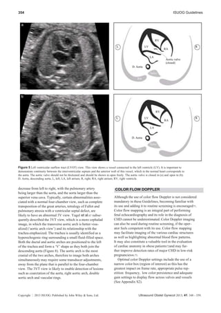 ISUOG Practice Guidelines (updated): sonographic screening examination ...