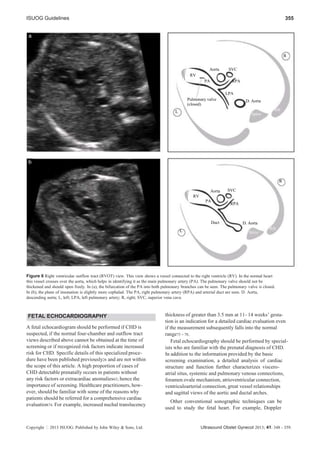 ISUOG Practice Guidelines (updated): sonographic screening examination ...