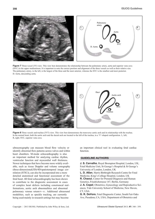 ISUOG Practice Guidelines (updated): sonographic screening examination ...