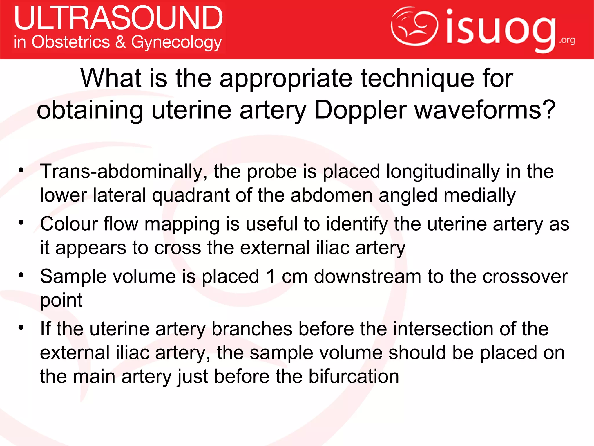 ISUOG Practice Guidelines: Use of Doppler ultrasonography in obstetrics ...