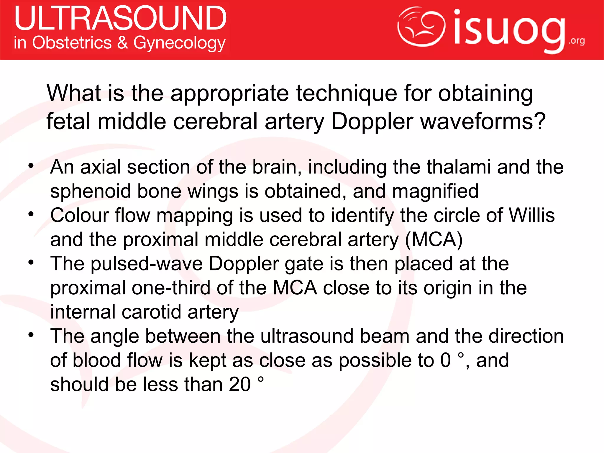 ISUOG Practice Guidelines: Use of Doppler ultrasonography in obstetrics ...