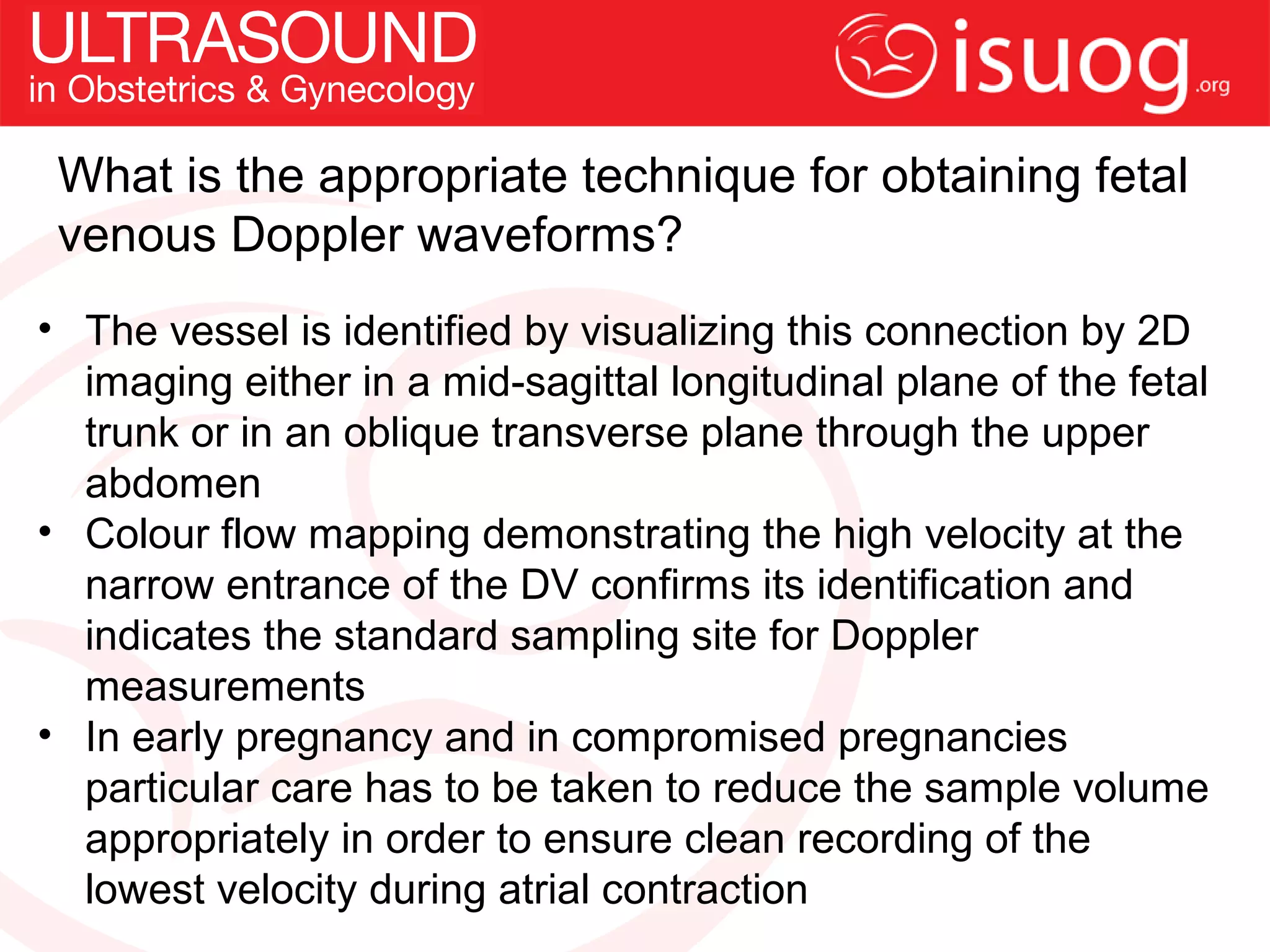 ISUOG Practice Guidelines: Use of Doppler ultrasonography in obstetrics ...