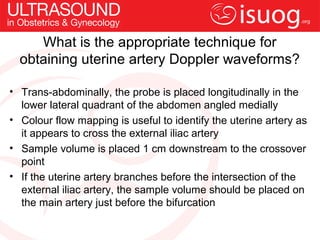 ISUOG Practice Guidelines: Use of Doppler ultrasonography in obstetrics ...