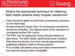 ISUOG Practice Guidelines: Use of Doppler ultrasonography in obstetrics ...