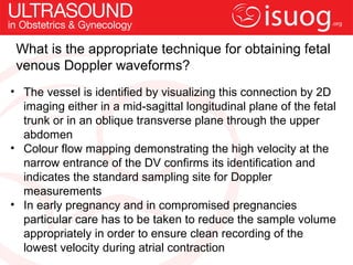 ISUOG Practice Guidelines: Use of Doppler ultrasonography in obstetrics ...