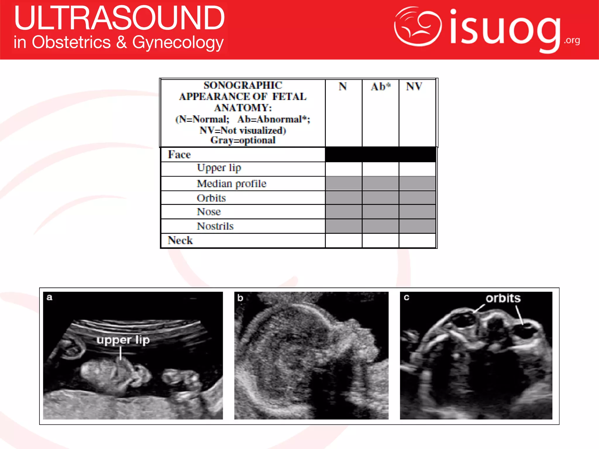 ISUOG Mid-trimester Guidelines | PPT