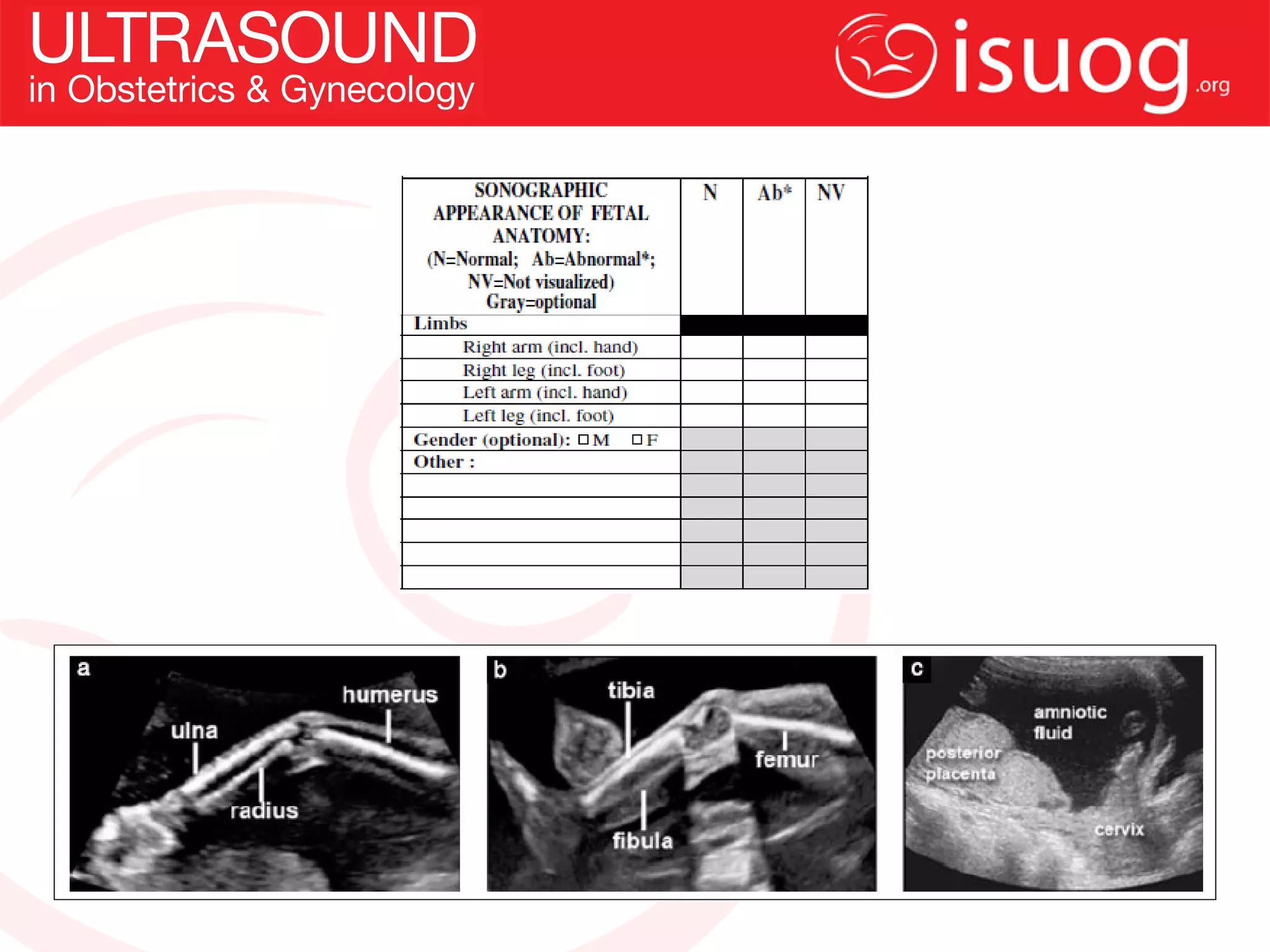 ISUOG Mid-trimester Guidelines | PPT