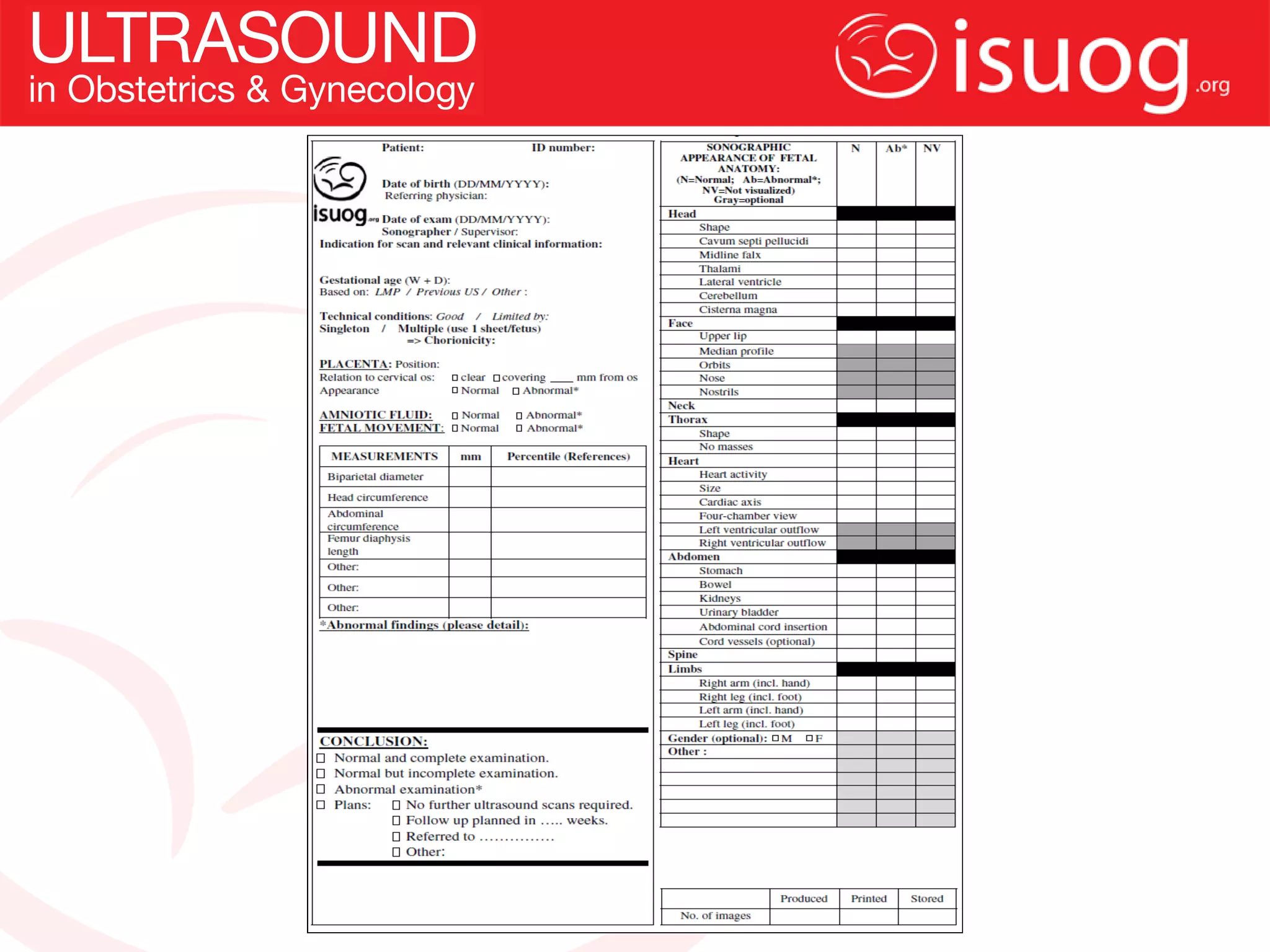 ISUOG Mid-trimester Guidelines | PPT