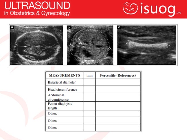 ISUOG Mid-trimester Guidelines | PPT