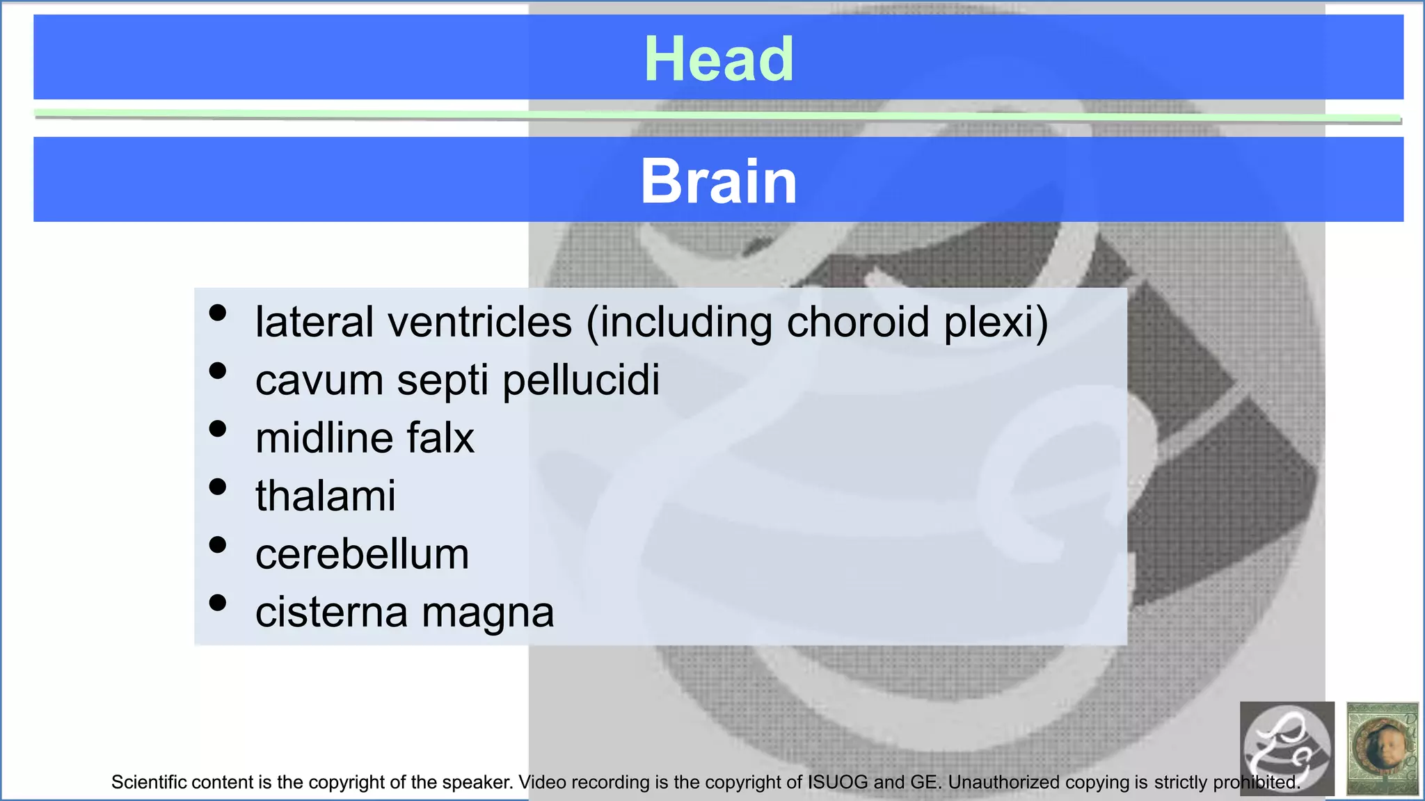 ISUOG 2nd trimester guidelines - Dr.Ashok Khurana | PPTX