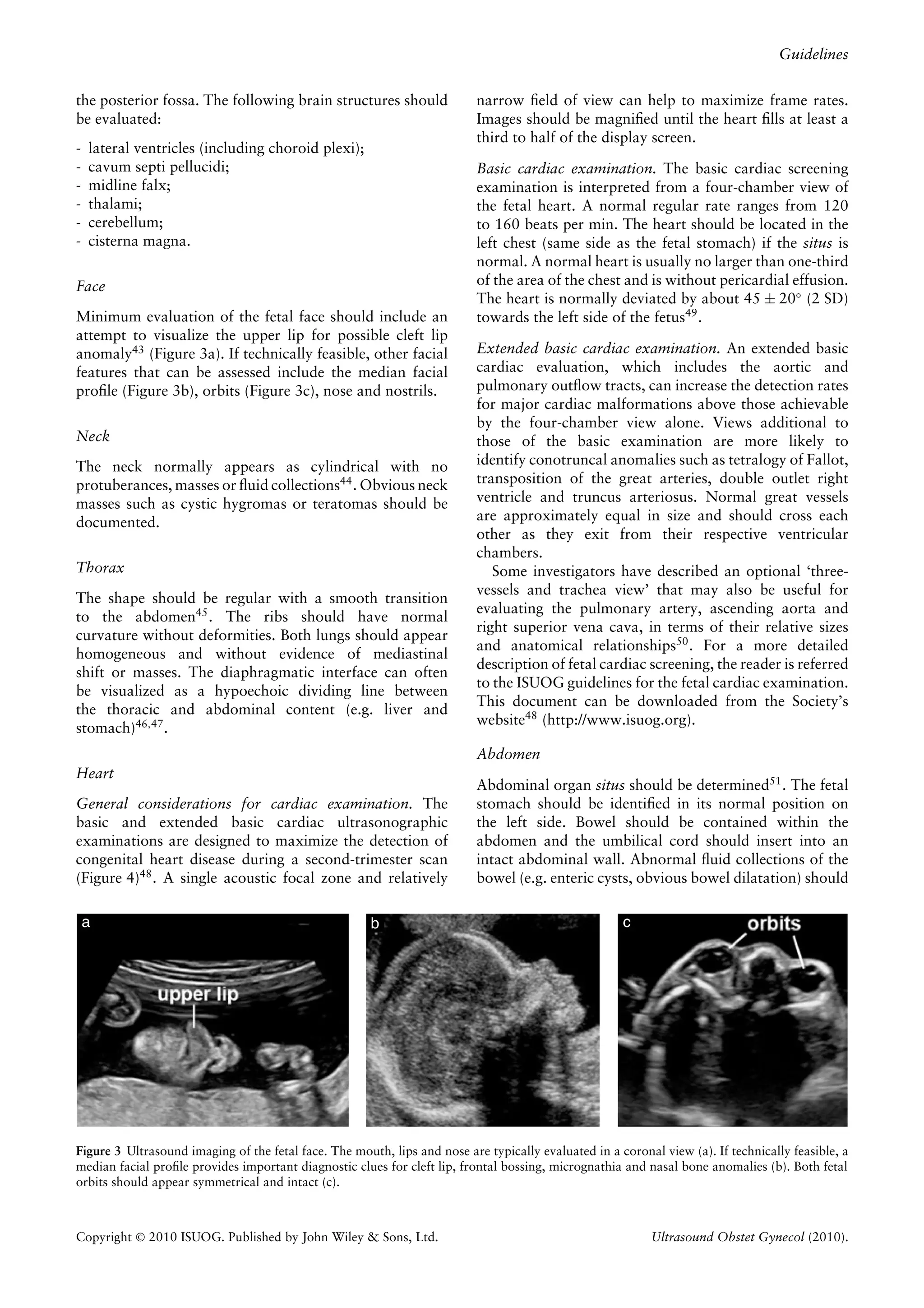 Guía ISUOG sobre ecografía del segundo trimestre | PDF