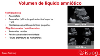 ISUOG Distinguiendo entre la anatomía fetal normal y la anatomía fetal ...