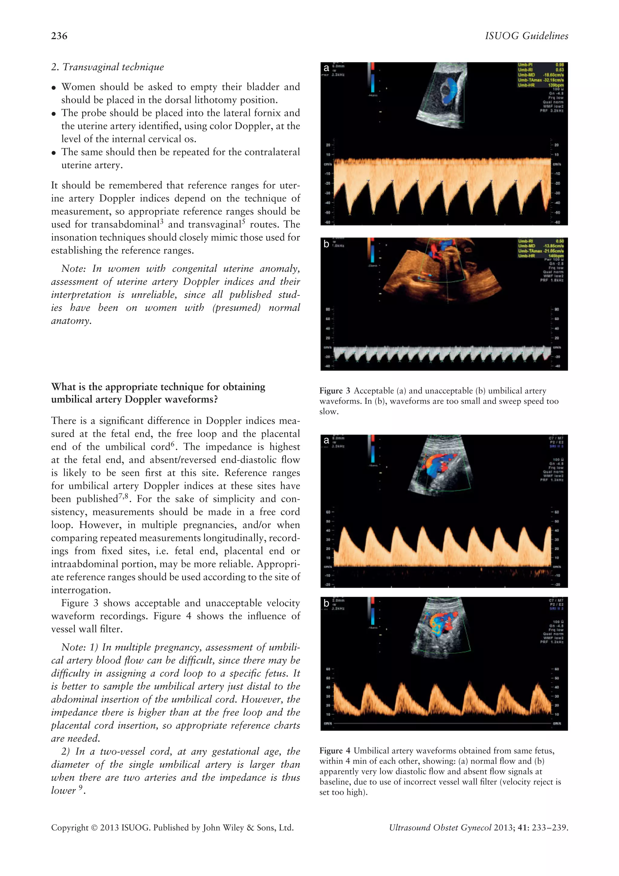 Guía ISUOG de Doppler obstétrico | PDF