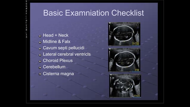 Isuog fetal cns usg guidelines | PPTX | Pregnancy | Reproductive Health
