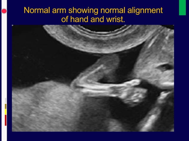 Isuog Practice Guidelines Performance Of First Trimester Fetal