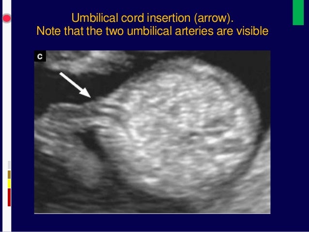 Isuog Practice Guidelines Performance Of First Trimester Fetal Ultras…