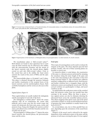 Guía ISUOG sobre ecografía del SNC | PDF