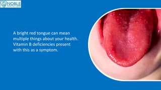 Is Your Tongue is Healthy? Does it Matter? | PPTX