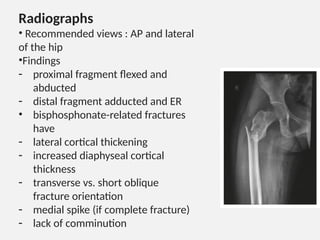IT.pptx intertrochanteric fracture femur | PPTX