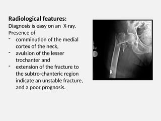 IT.pptx intertrochanteric fracture femur | PPTX