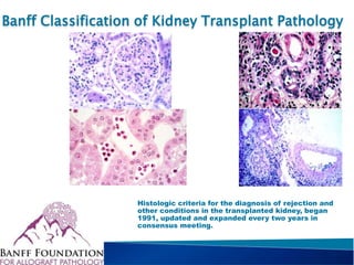 IT and me reflections Kim Solez | PPT