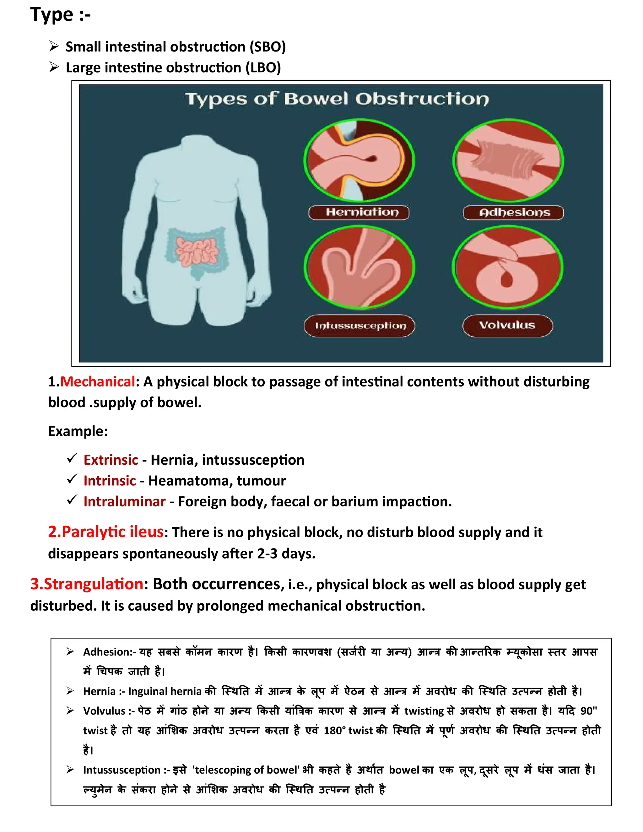 Intestinal obstruction in MEDICAL SURGICAL NURSING Jitendra bhargav ...