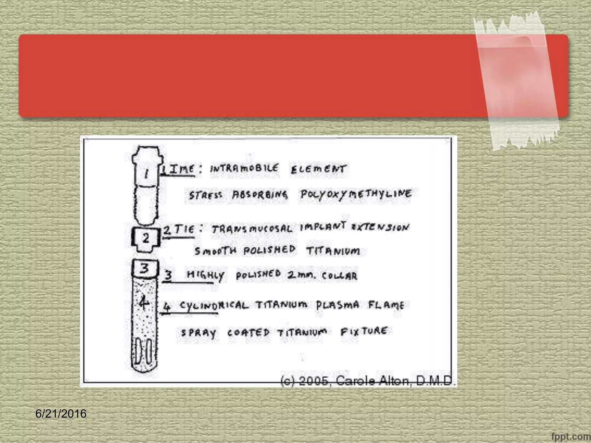 Implant tooth connection | PPTX | Dental Health | Diseases and Conditions