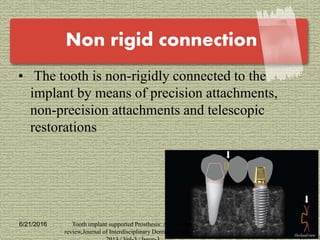 Implant tooth connection | PPTX | Dental Health | Diseases and Conditions