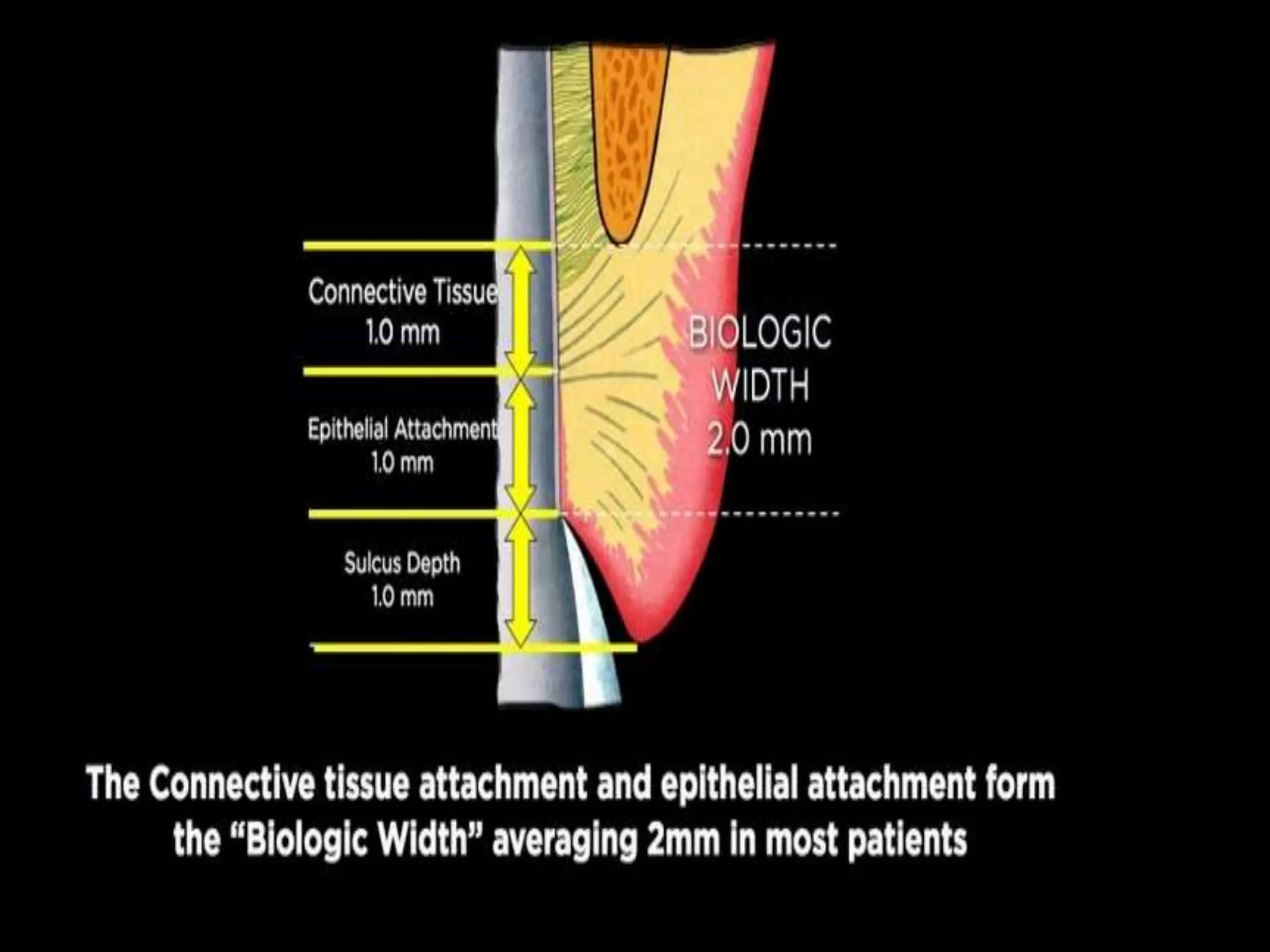 Implant tooth connection | PPTX