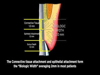 Implant tooth connection | PPTX