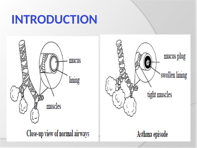 induced model of brochial asthma in rats.pptx