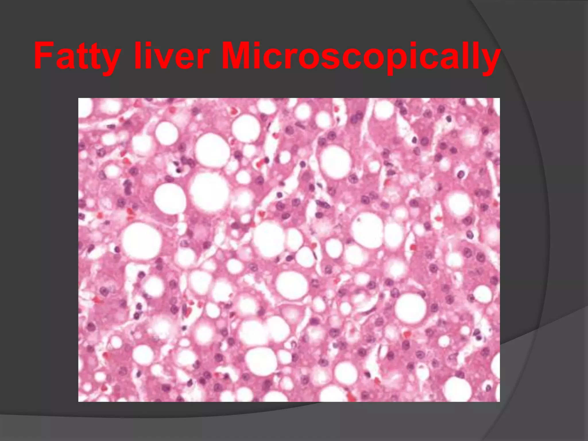 intracellular accumulations, calcifications and cellular ageing. | PPTX