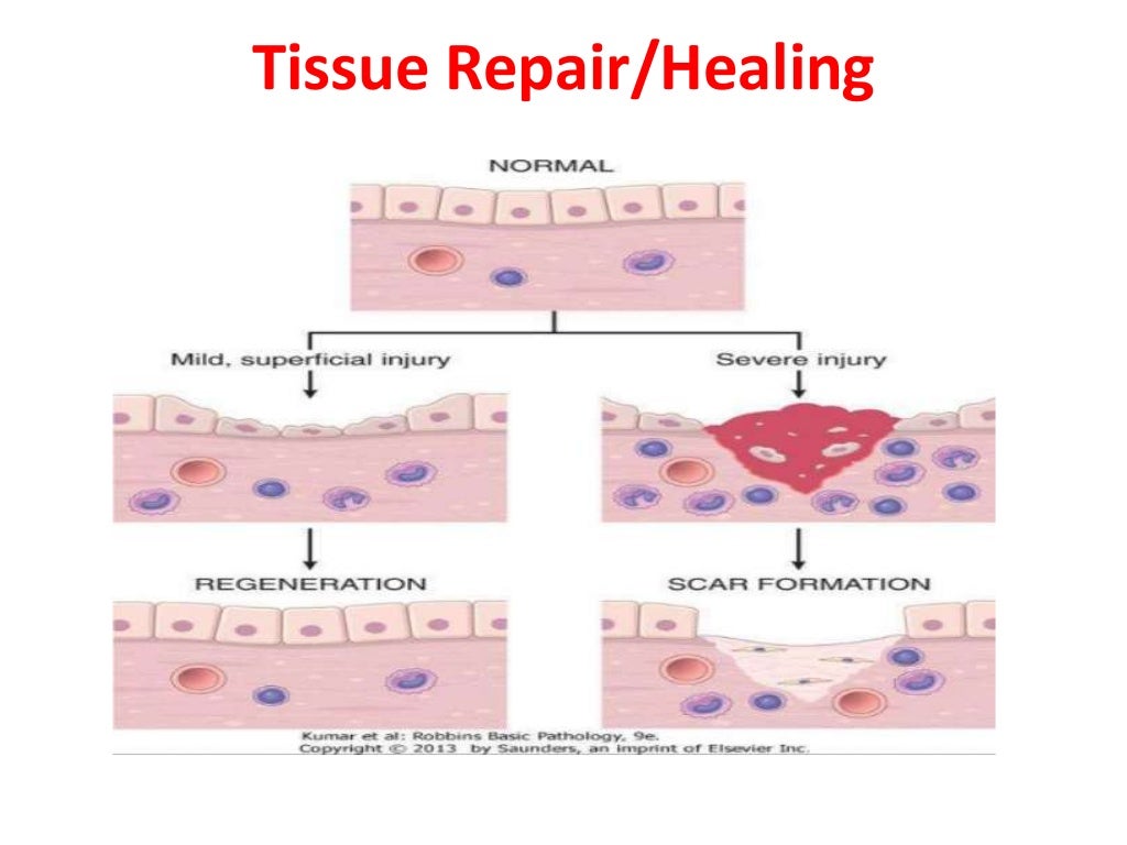 healing and tissue repair