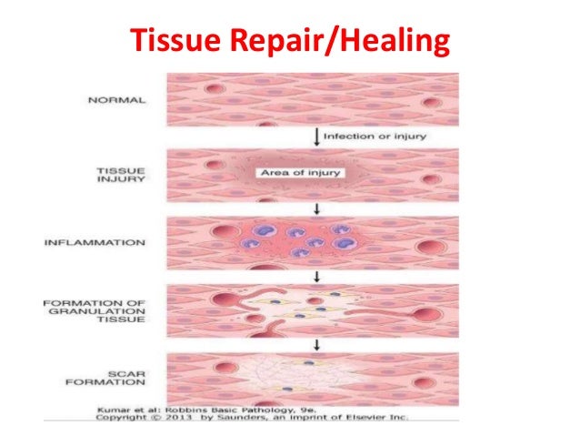 healing and tissue repair