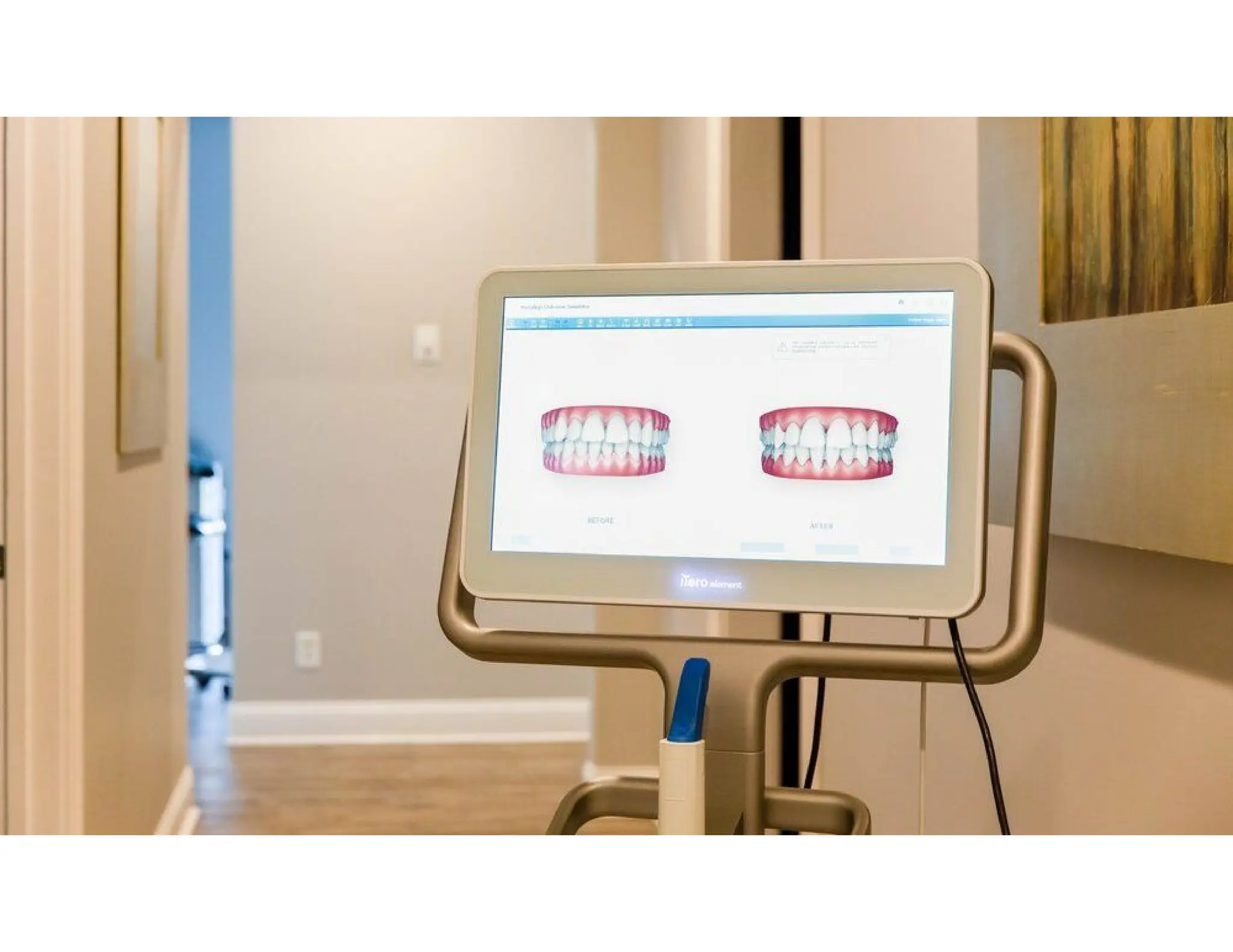 iTero scanner at Wrightsville Dental Wilmington NC.pdf