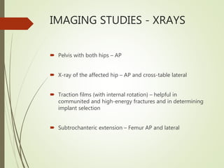 fracture It femur | PPTX