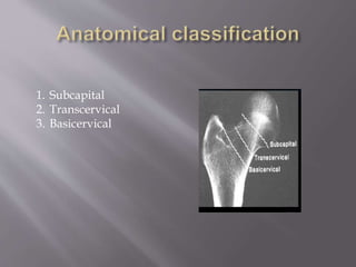 #It femur and #nof | PPT