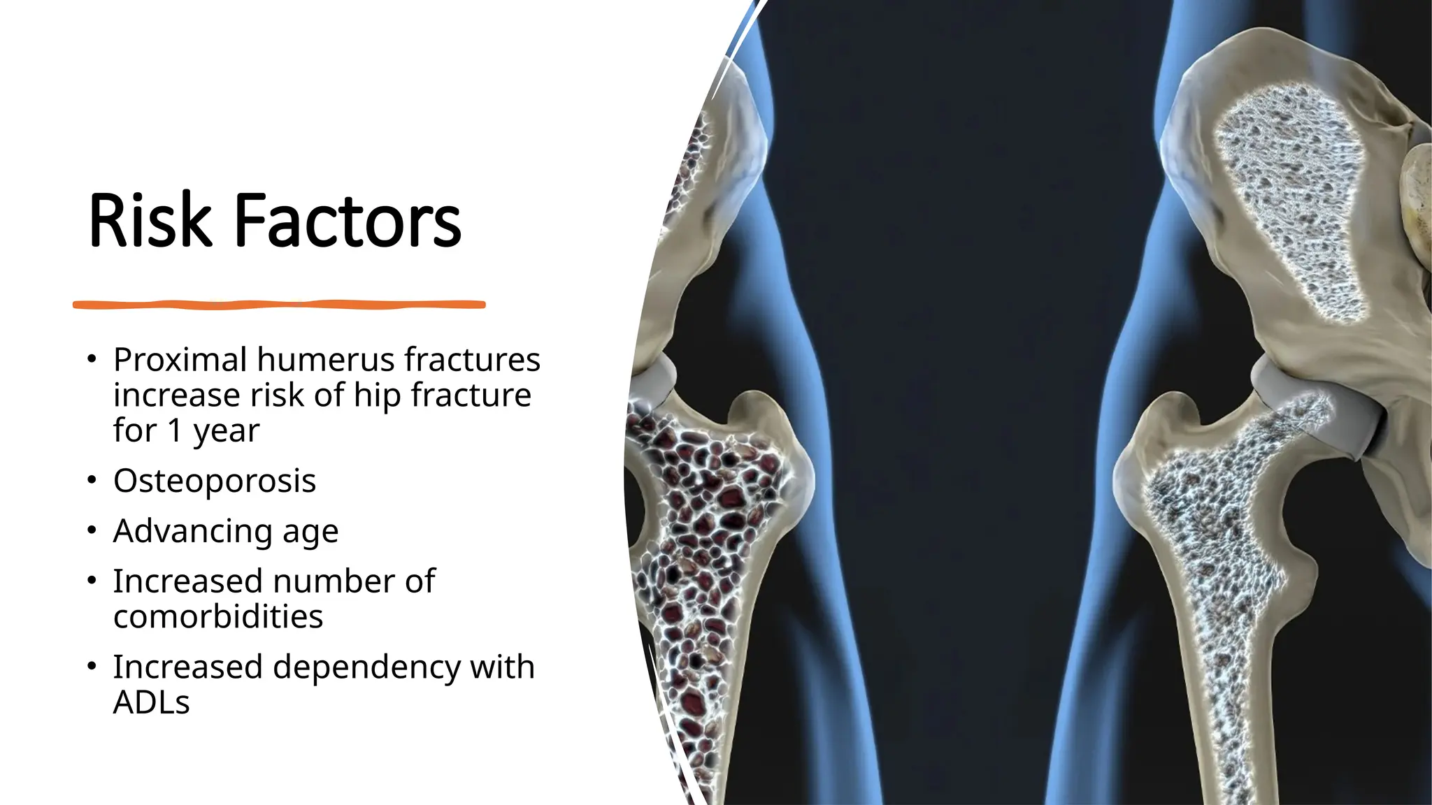 IT fracture.pptx inter trochenteric fractures. | PPT
