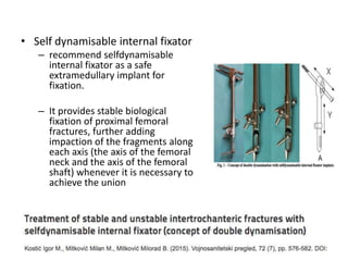 Intertrochanteric fracture management | PPTX