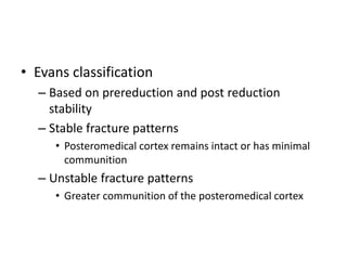 Intertrochanteric fracture management | PPTX