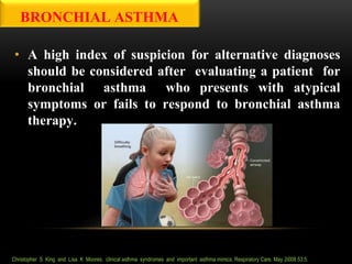 It is not asthma | PPTX