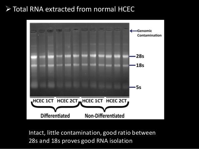 The expression of ITPK in normal colon and colorectal cancer cells