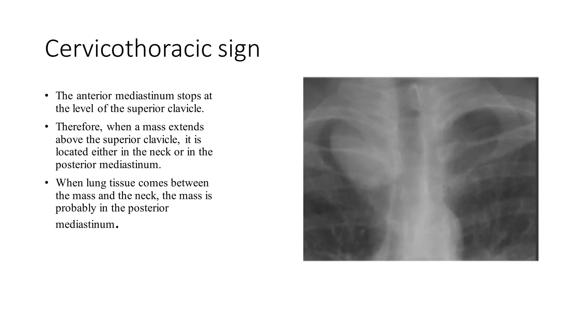 ITMIG classification posterior mediastinal masses.pdf