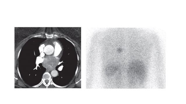 ITMIG classification posterior mediastinal masses.pdf