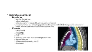 ITMIG classification posterior mediastinal masses.pdf