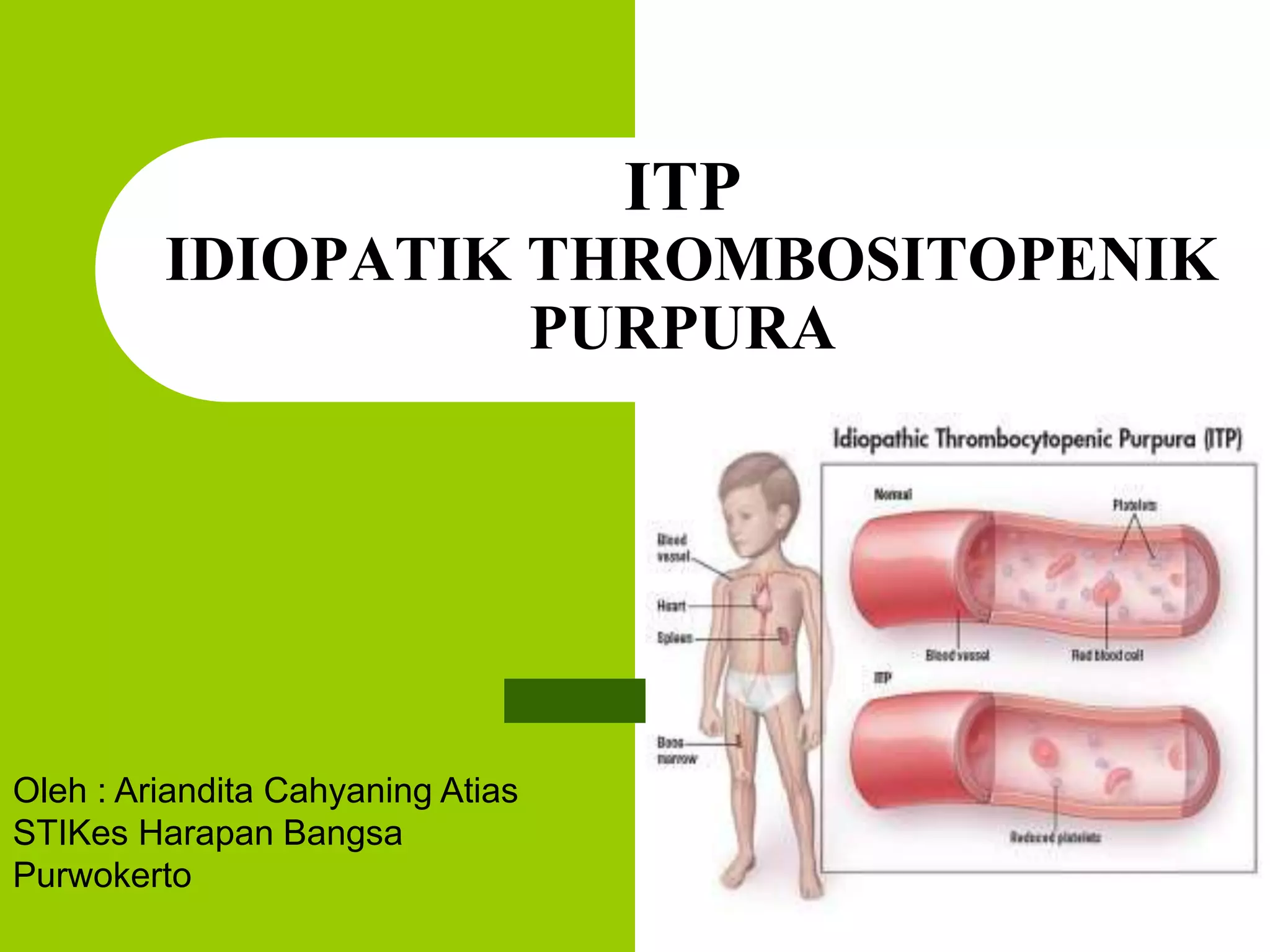 ITP (IDIOPATIK THROMBOSITOPENIK PURPURA) | PPTX