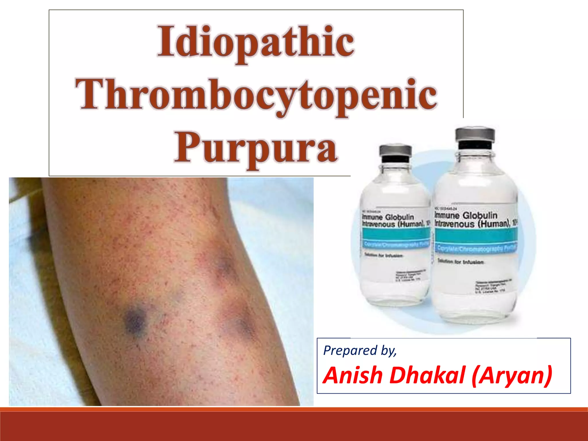 Idiopathic Thrombocytopenic Purpura | PPTX