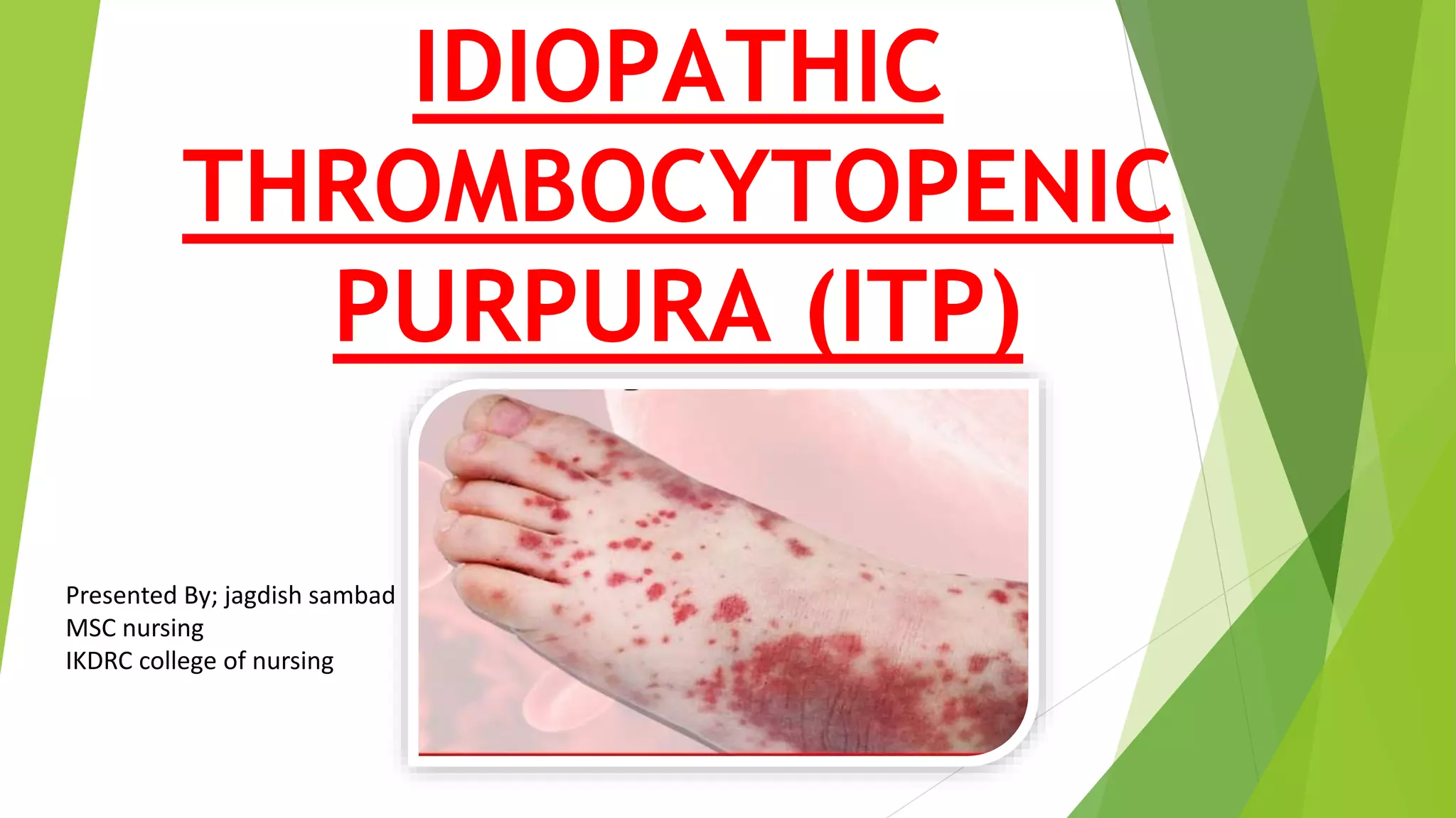 IDIOPATHIC THROMBOCYTOPENIC PURPURA (ITP) | PPTX